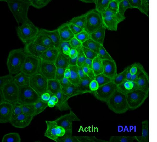 SQ-20B Human Squamous Cell Carcinoma Cell Line | SCC287